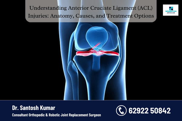 Understanding Anterior Cruciate Ligament (ACL) Injuries